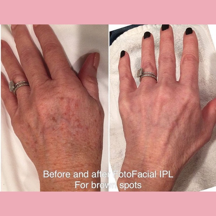 Before And After Photos | Beauty Religion